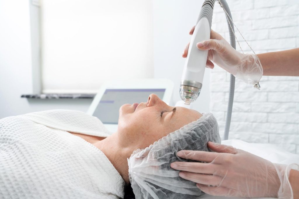 Revive Your Skin with Laser Treatment for Acne Scars