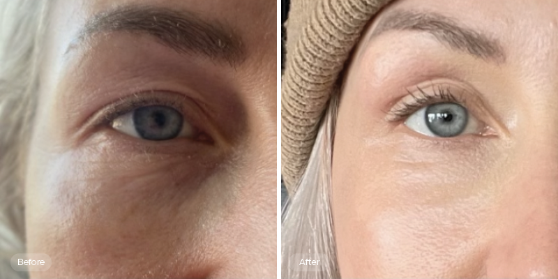 Our Work - Visage Medical Aesthetics Regina | Botox, Lip Filler, PRP Hair